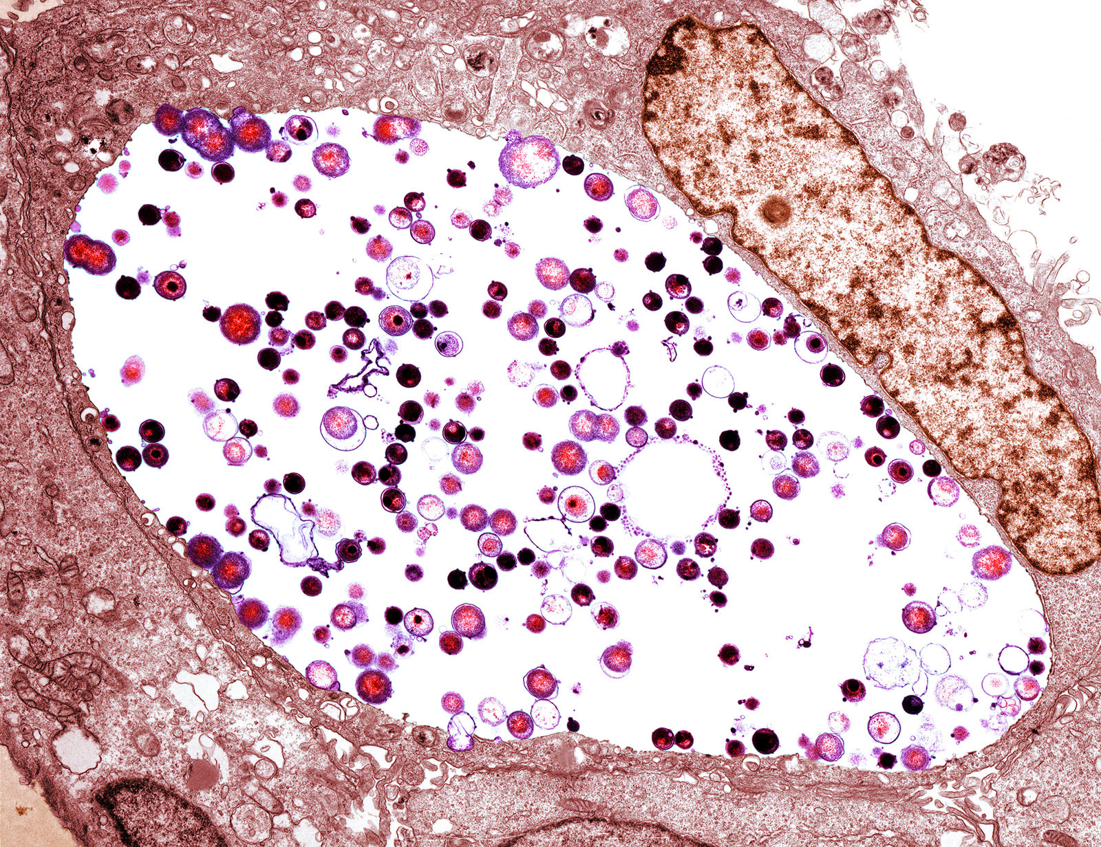 Record High Number Of STD Infections In U S As Prevention Funding record-high-number-of-std-infections-in-u-s-as-prevention-funding