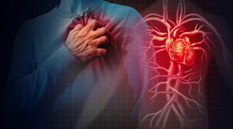 Quand la COVID-19 frappe au cœur - Clinique CME