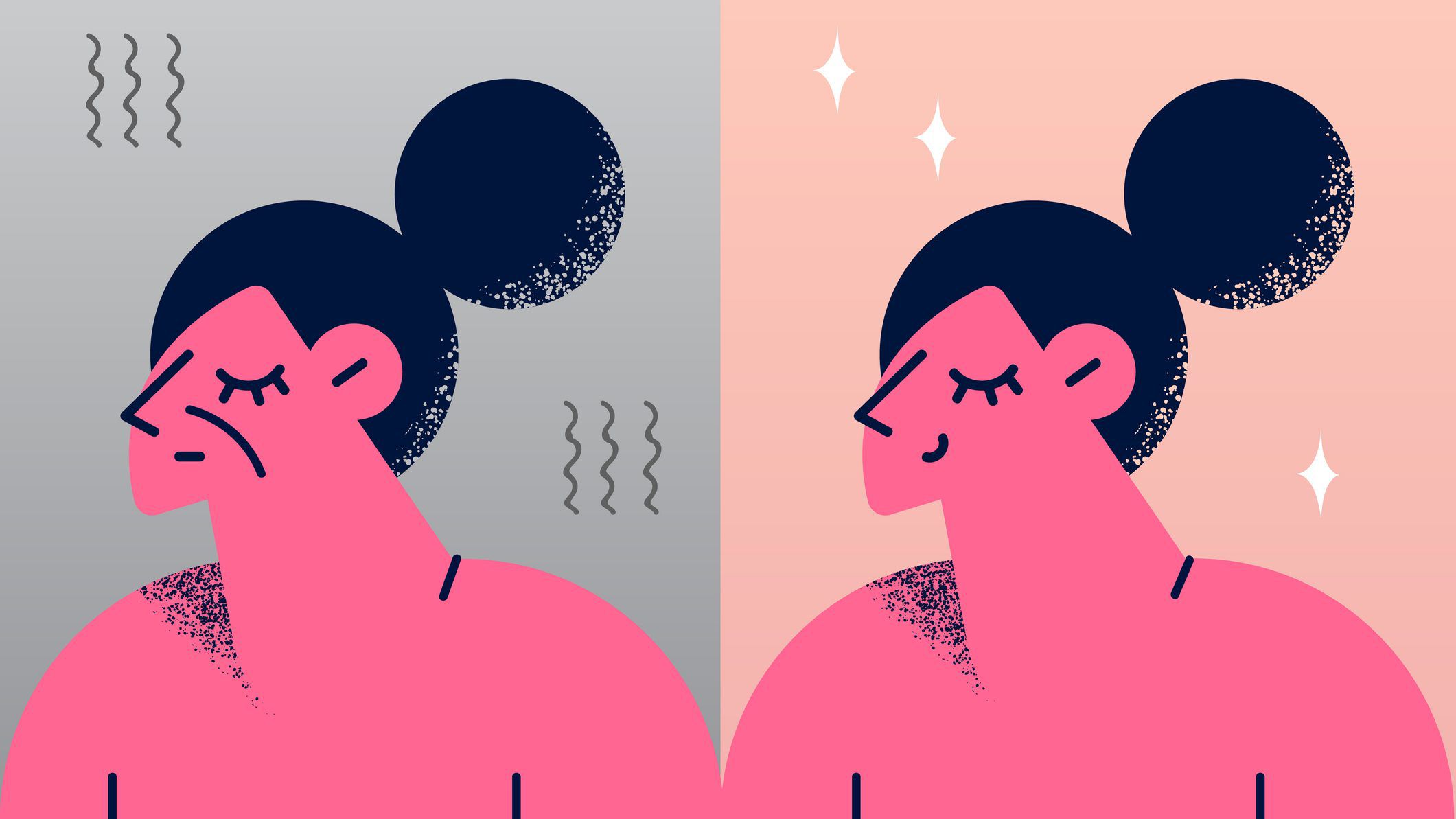 People treated with Botox report feeling less anxiety: Study - Clinique CME