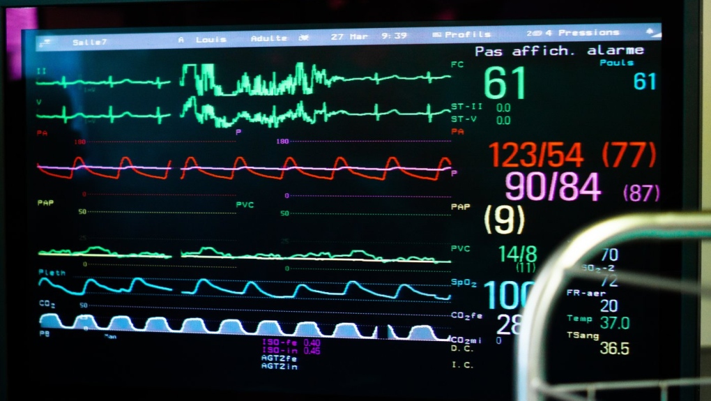 Women suffering from heart attacks wait longer than men for treatment ...